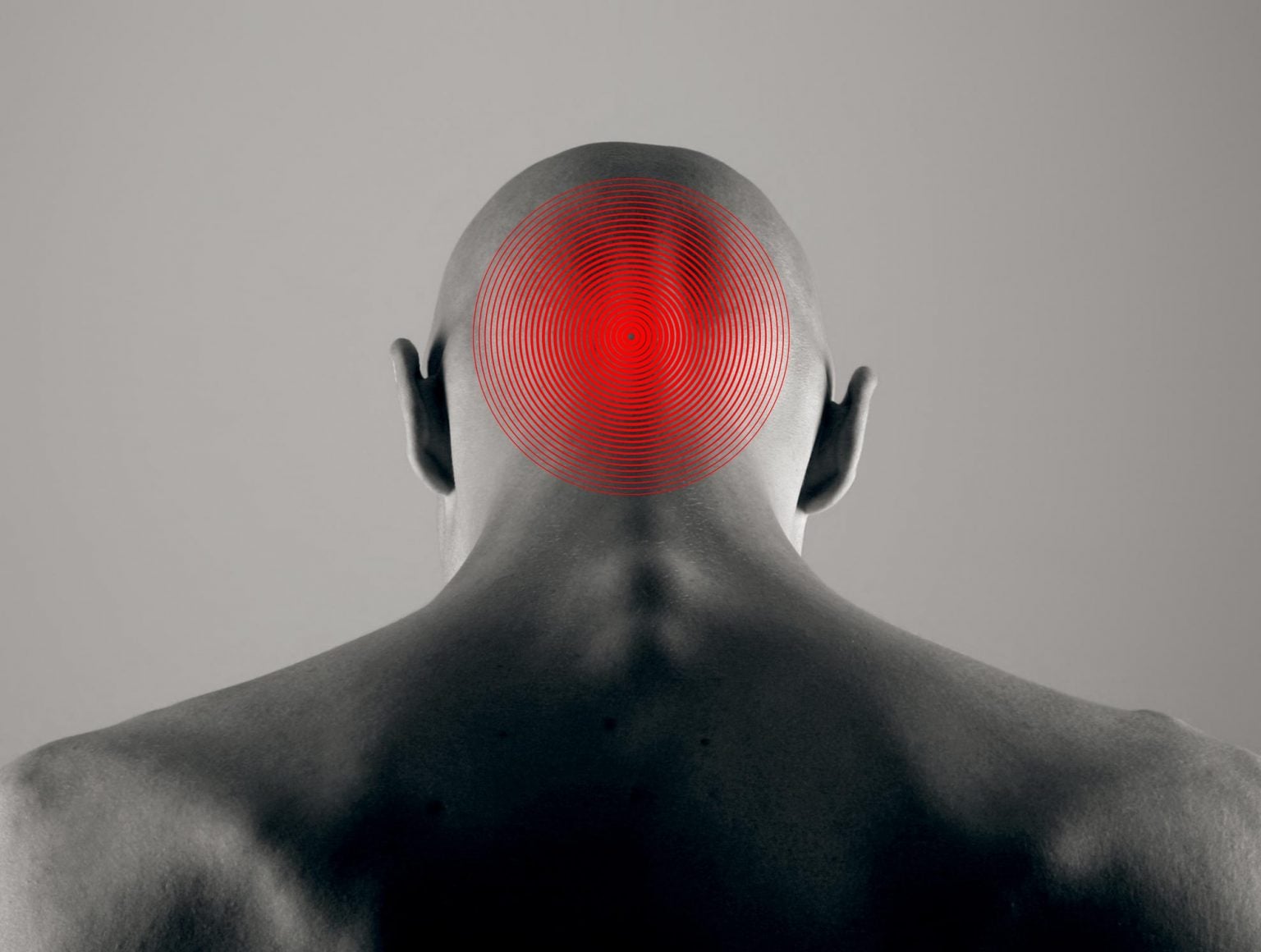 Neuralgia Occipital: ¿Qué Es y Cómo Se Trata?